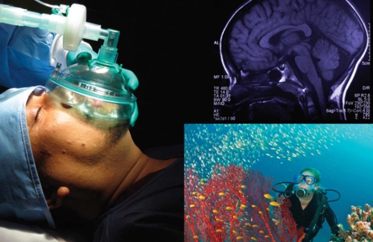 Case Control Study Hyperbaric Oxygen Treatment Of Mild Traumatic Brain case-control-study-hyperbaric-oxygen-treatment-of-mild-traumatic-brain